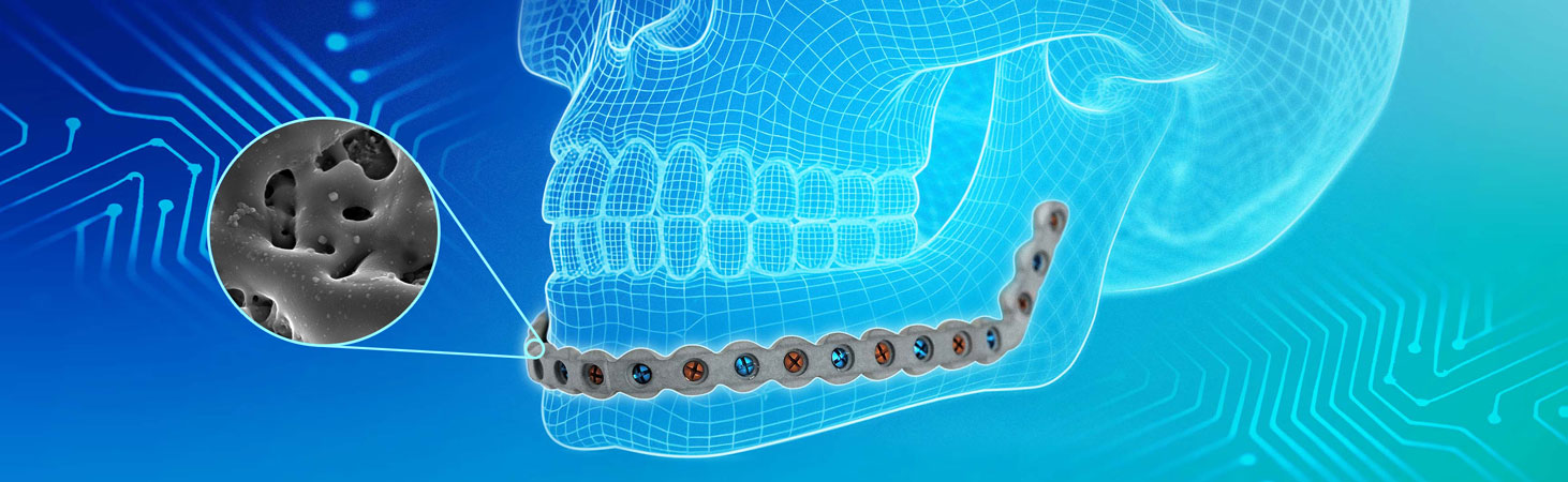 MAOmed | Anti-Inflammatory Surface Coating Enhances the Compatibility ...